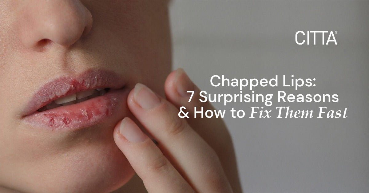 cracked lips causes